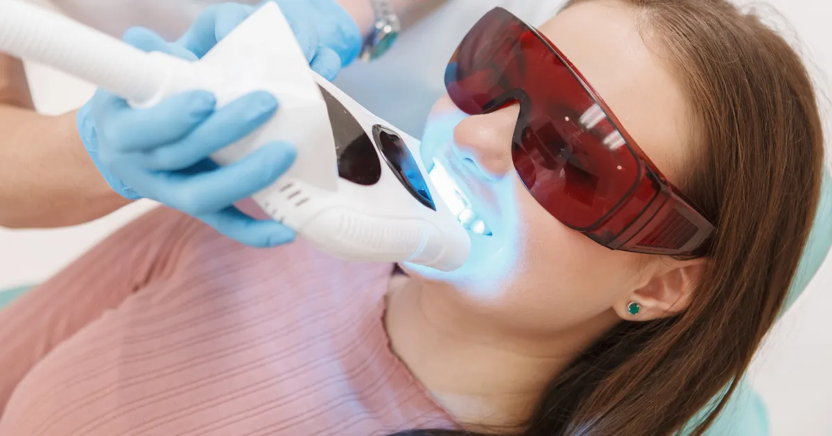 Best Teeth Whitening Explained by a North Raleigh Cosmetic Dentist